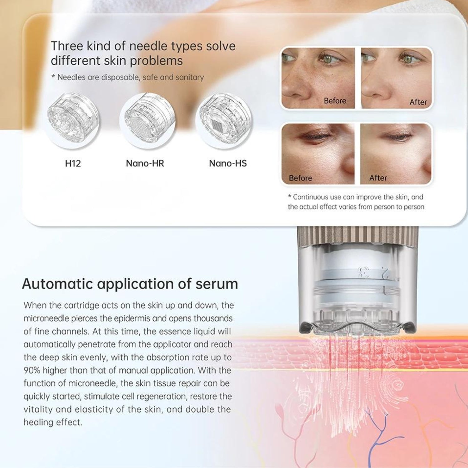 HYDRAPEN H6 HIDRA DERMAPEN CON FOTOTERAPIA HYDRADERMAPEN – IEF-CLINIC ...