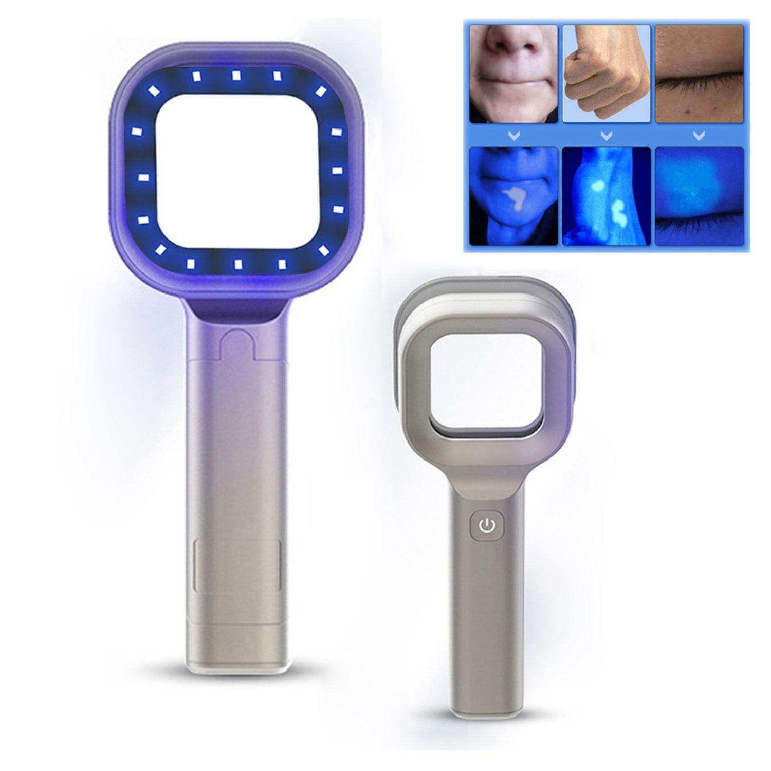 LAMPARA DE WOOD LUZ NEGRA DIAGNOSTICO PIEL